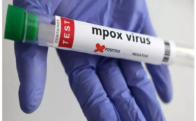 ಕೇರಳ | ಎಂಪಾಕ್ಸ್ ಸೋಂಕು ದೃಢ : ಆರೋಗ್ಯ ಇಲಾಖೆ | Kerala | Empox infection ...